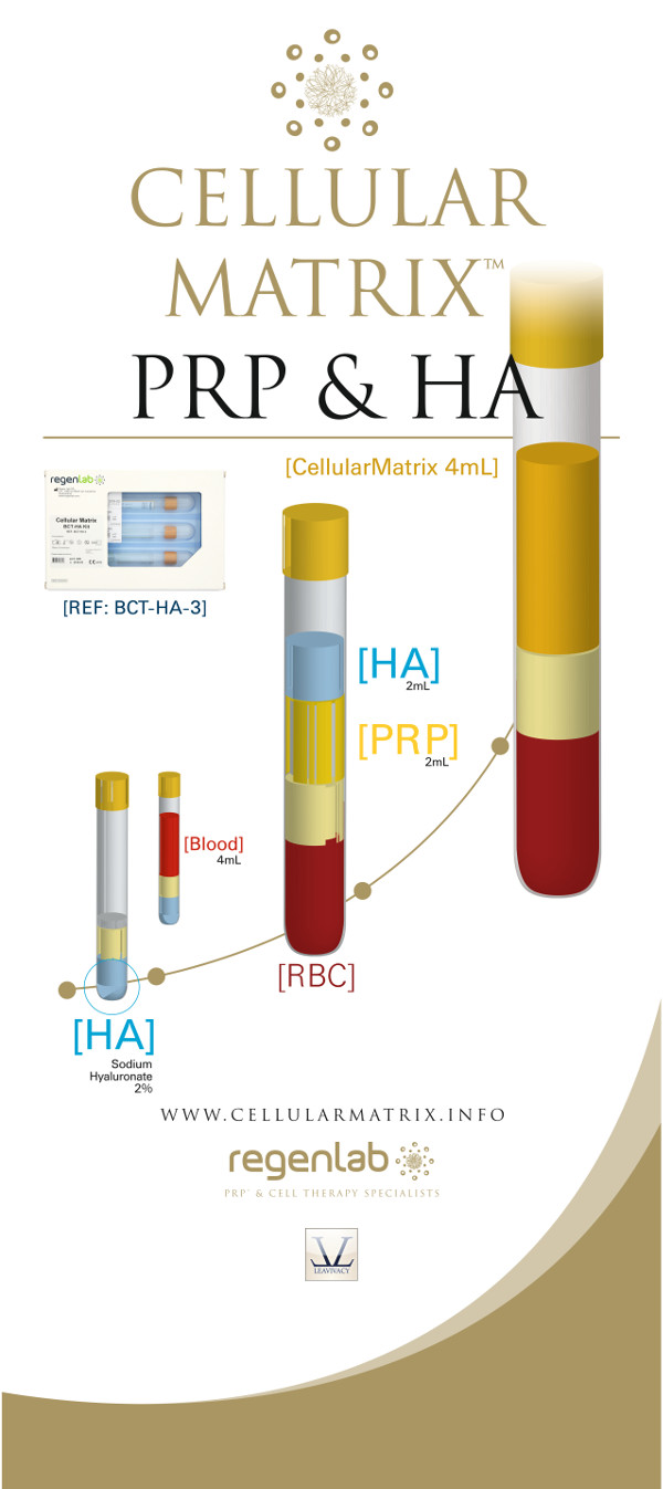 Osocze bogatopłytkowe (PRP) i kwas hialuronowy w jednym